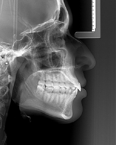 Dental X-Rays | teeth.org.au